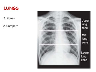 basics of chest xray | PPT