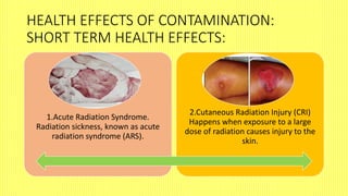 Radioactive contamination (2) | PPTX