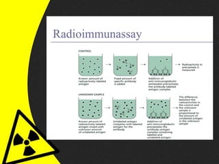 Radioactive techniques