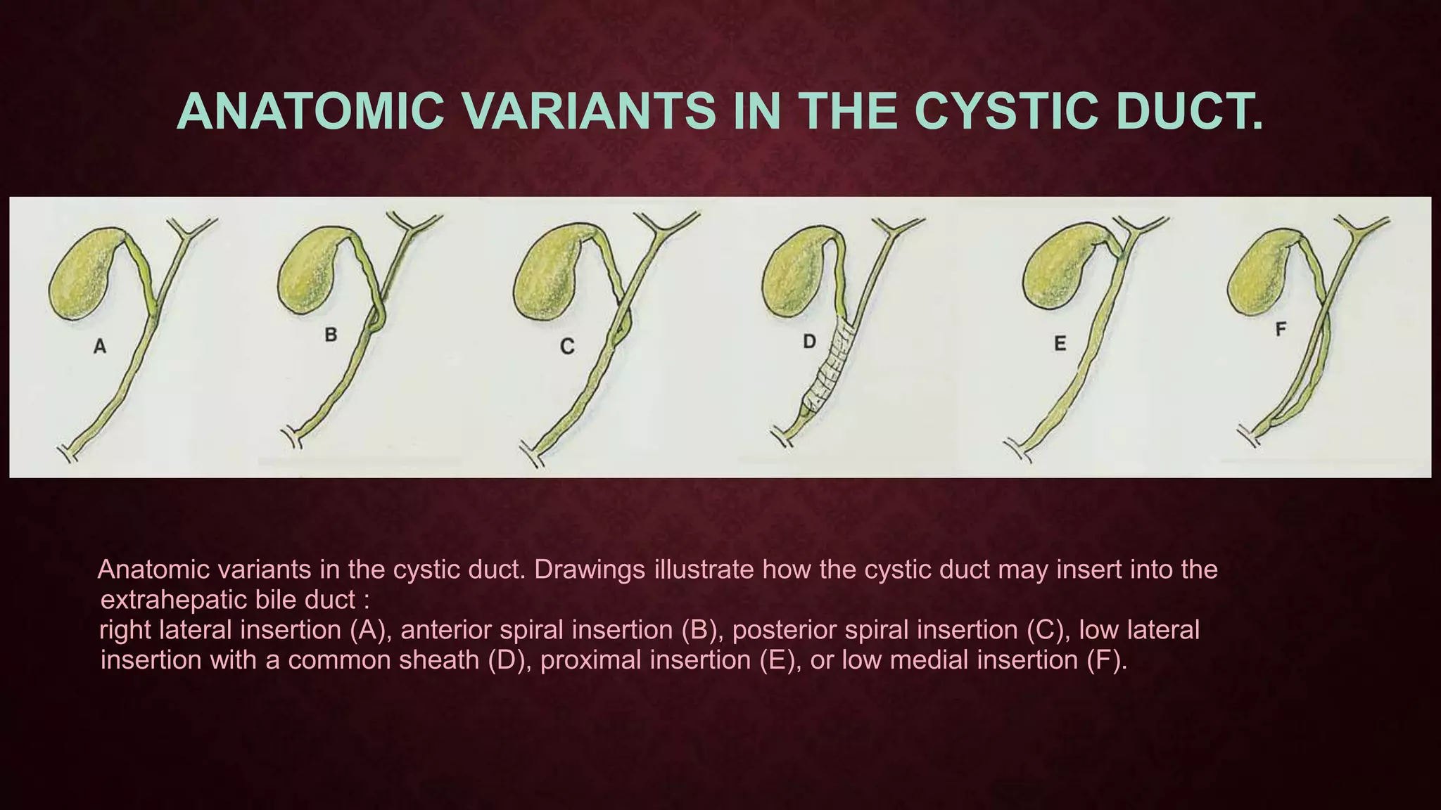 Radioanatomy of biliary system | PPTX