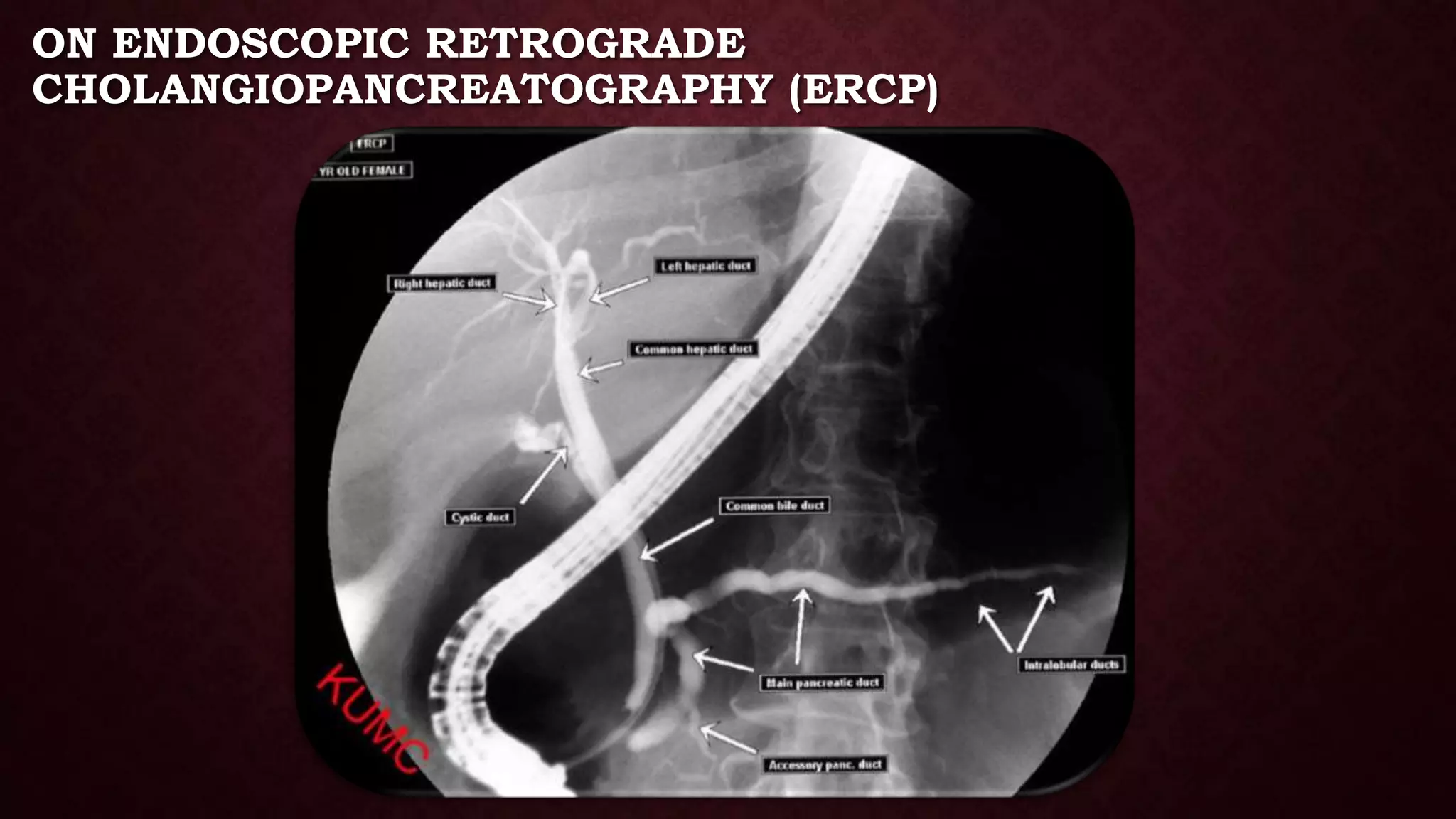 Radioanatomy of biliary system | PPTX