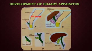 Radioanatomy of biliary system | PPTX