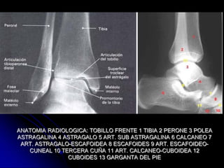 Radioanatomia del pie y tobillo | PDF