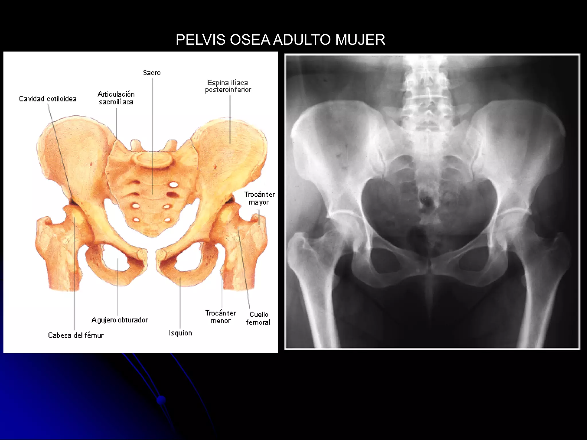 Radioanatomia de pelvis osea | PDF