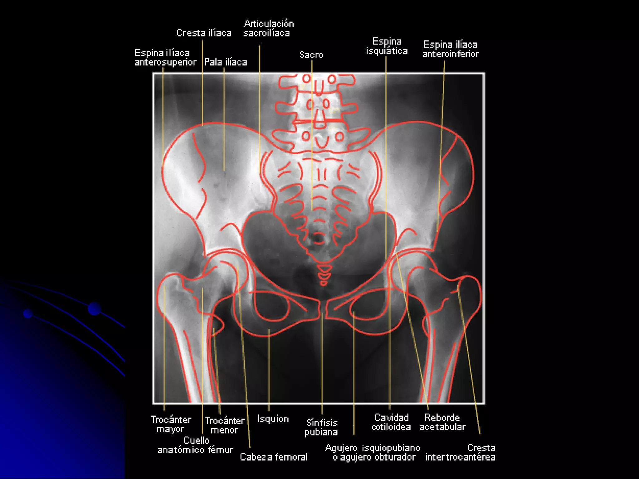 Radioanatomia de pelvis osea | PDF