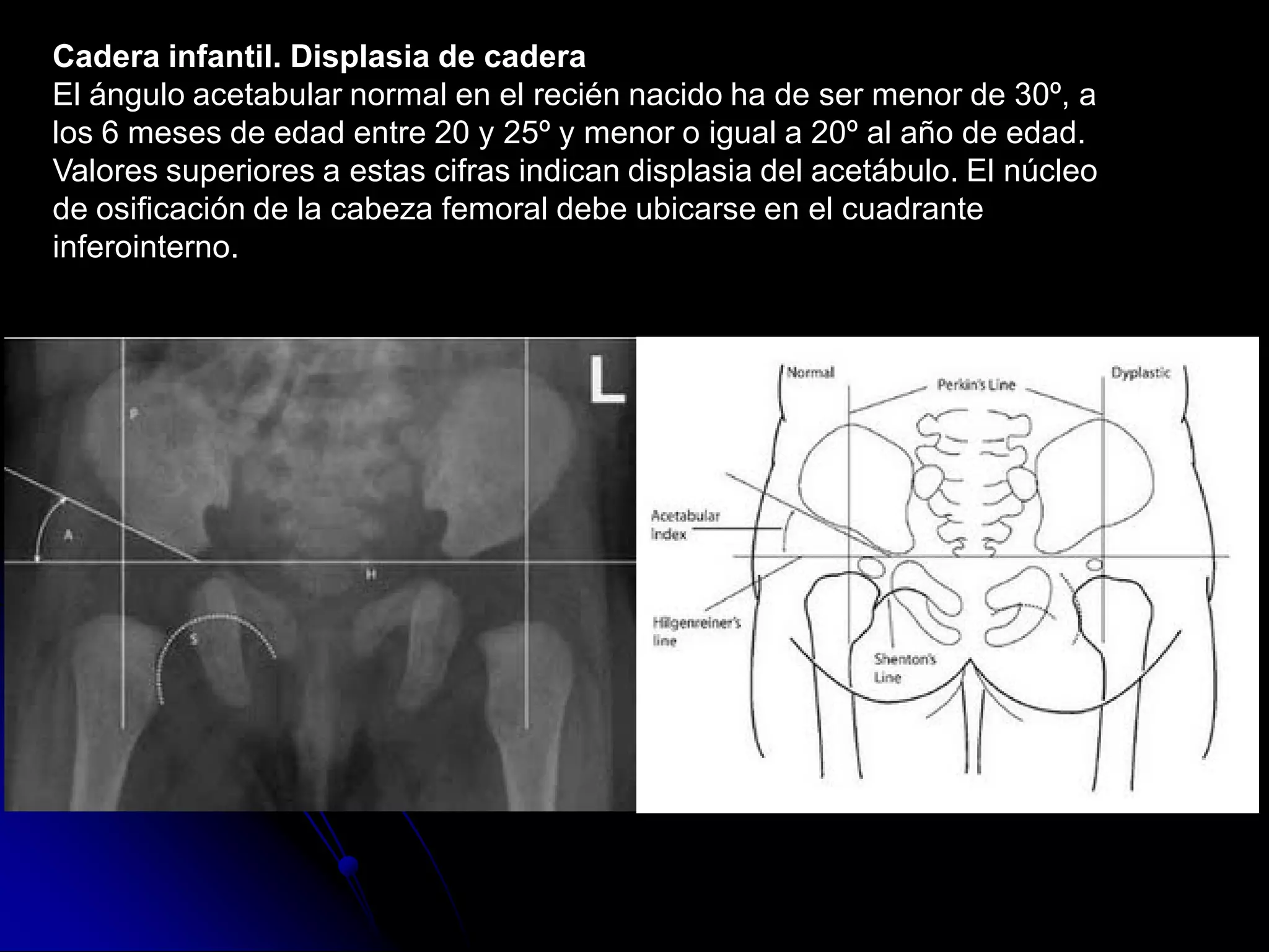 Radioanatomia de pelvis osea | PDF