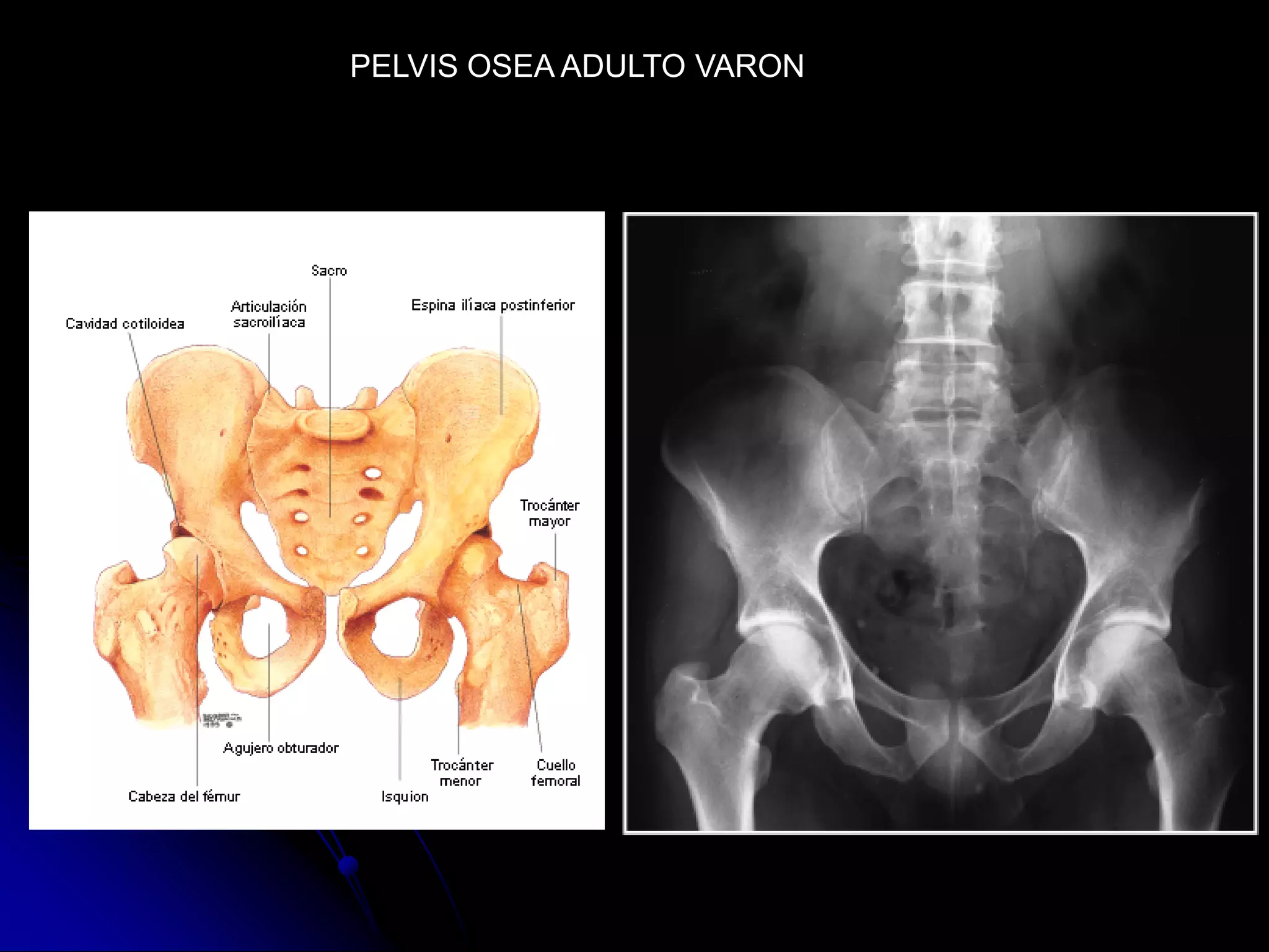 Radioanatomia de pelvis osea | PDF