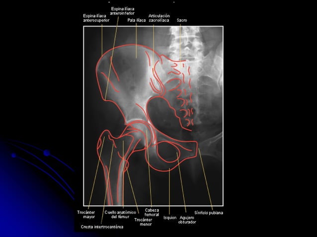 Radioanatomia de pelvis osea | PDF