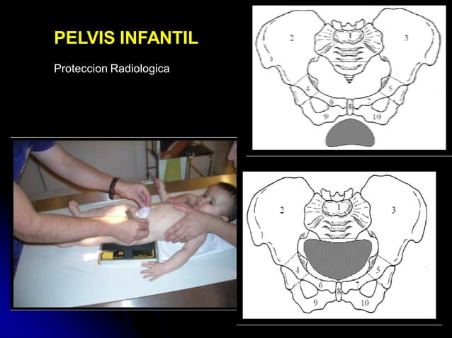 Radioanatomia de pelvis osea | PDF