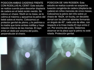 Radioanatomia de pelvis osea | PDF
