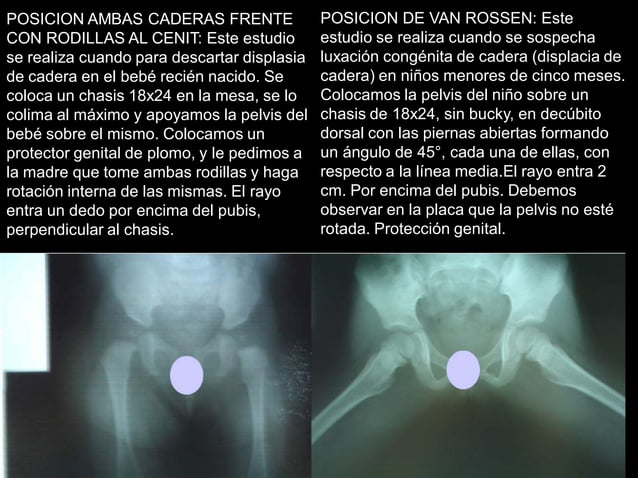 Radioanatomia de pelvis osea | PDF