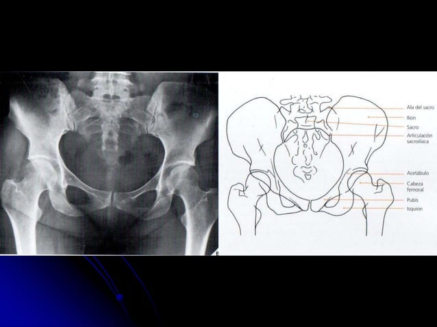 Radioanatomia de pelvis osea | PDF