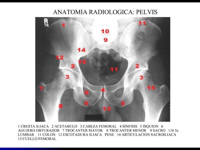 Radioanatomia de pelvis osea | PDF