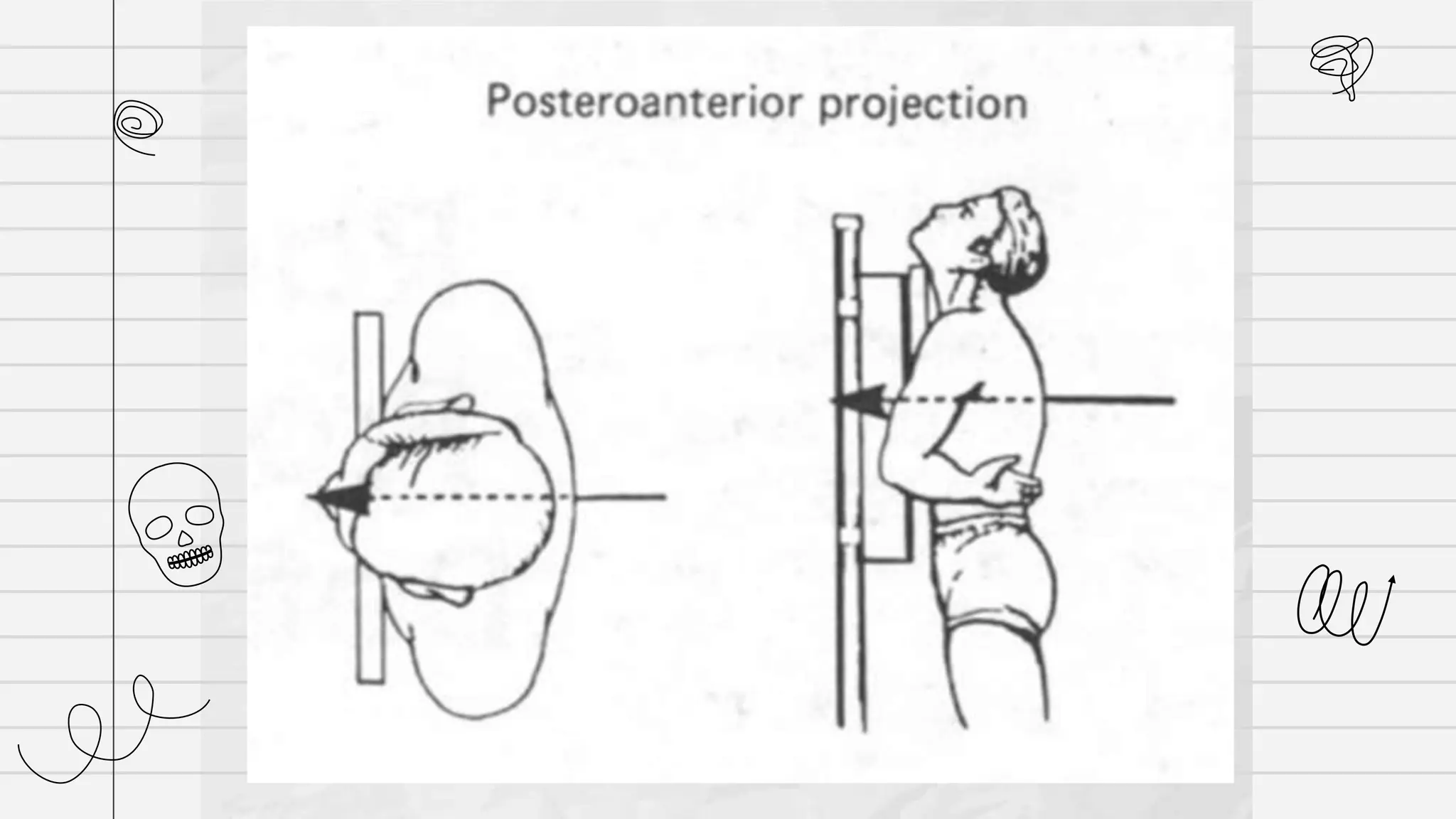 Radioanatomi Thorax_Andhina Shaffa A_4151211482.pptx