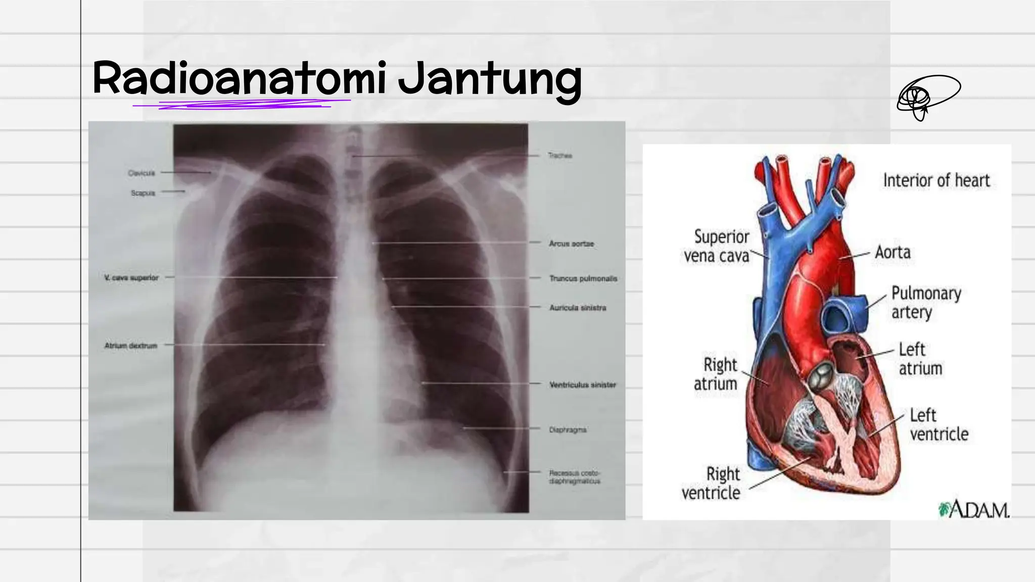 Radioanatomi Thorax_Andhina Shaffa A_4151211482.pptx
