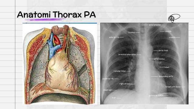 Radioanatomi Thorax_Andhina Shaffa A_4151211482.pptx