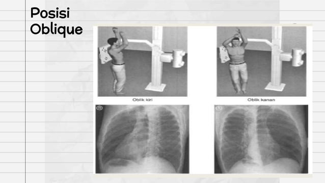 Radioanatomi Thorax_Andhina Shaffa A_4151211482.pptx