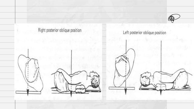 Radioanatomi Thorax_Andhina Shaffa A_4151211482.pptx