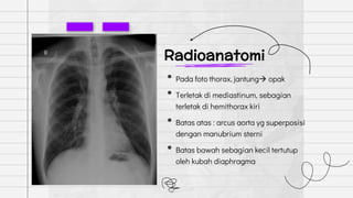 Radioanatomi Thorax_Andhina Shaffa A_4151211482.pptx