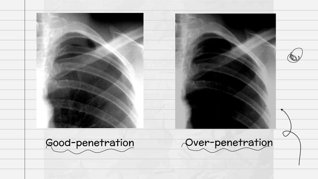 Radioanatomi Thorax_Andhina Shaffa A_4151211482.pptx