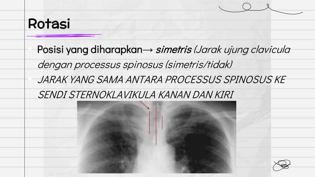 Radioanatomi Thorax_Andhina Shaffa A_4151211482.pptx