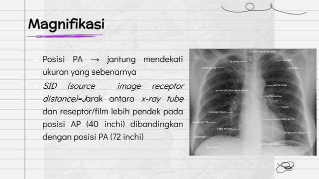 Radioanatomi Thorax_Andhina Shaffa A_4151211482.pptx