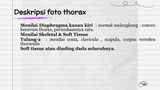Radioanatomi Thorax_Andhina Shaffa A_4151211482.pptx