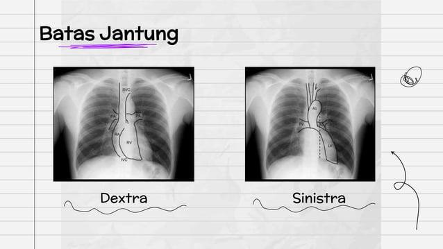Radioanatomi Thorax_Andhina Shaffa A_4151211482.pptx