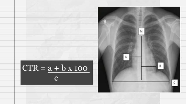 Radioanatomi Thorax_Andhina Shaffa A_4151211482.pptx