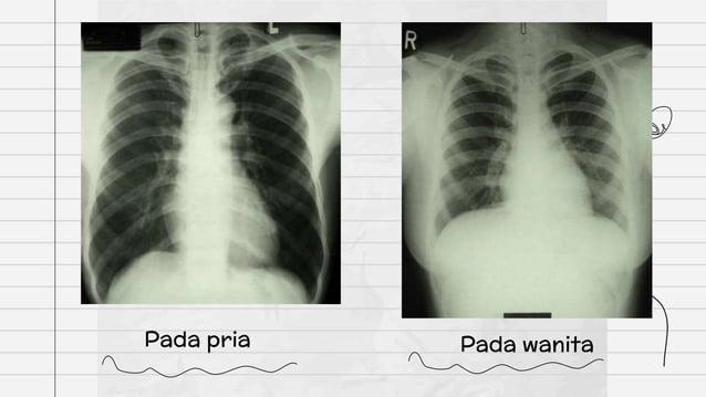 Radioanatomi Thorax_Andhina Shaffa A_4151211482.pptx