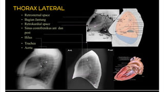 Radioanatomi Thorax_Andhina Shaffa A_4151211482.pptx
