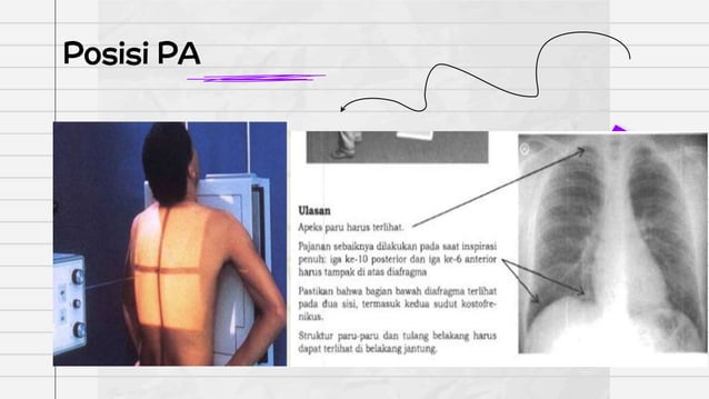 Radioanatomi Thorax_Andhina Shaffa A_4151211482.pptx