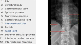 radio anatomy owieNDPOWPOMPDQMPEOWDMQPMODPQMOPQWOMP | PPT