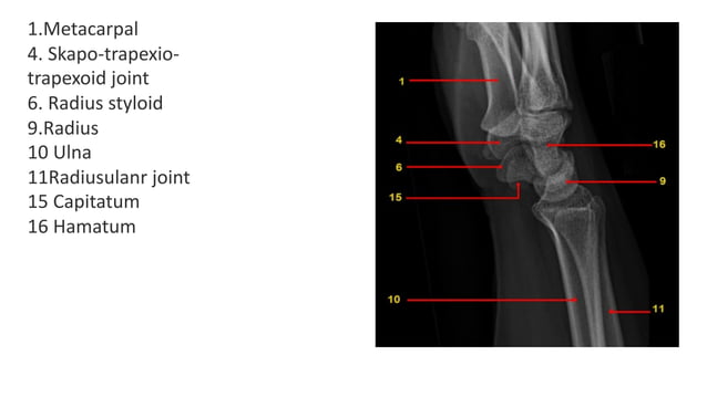 radio anatomy owieNDPOWPOMPDQMPEOWDMQPMODPQMOPQWOMP | PPT