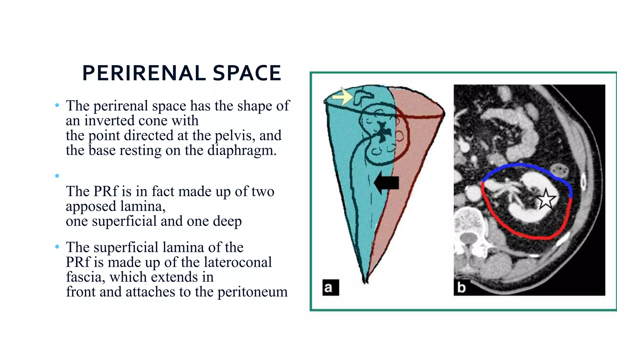 Radioanatomy of retroperitoneal space | PPTX | Design | Fine Art