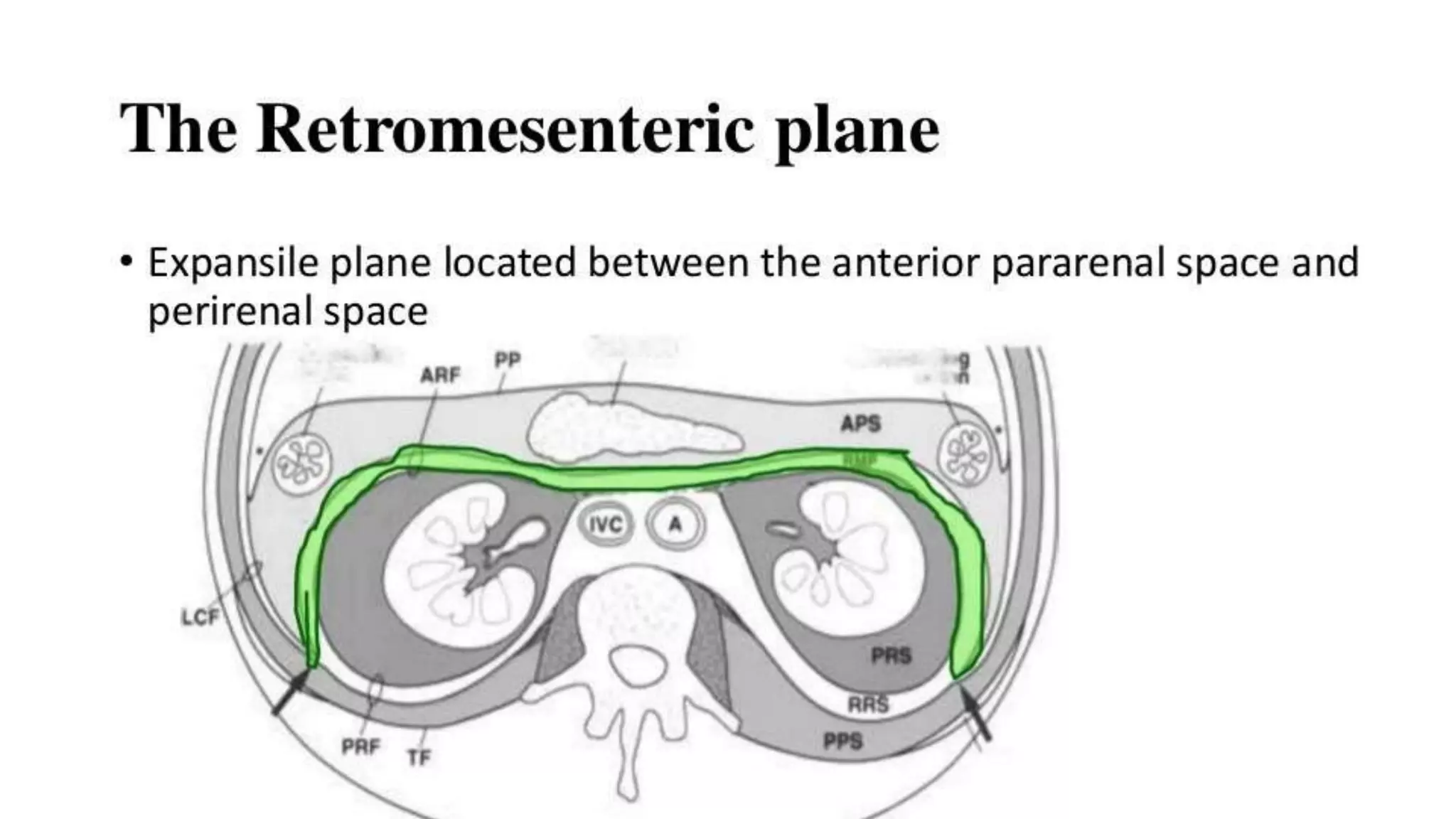 Radioanatomy of retroperitoneal space | PPTX | Design | Fine Art