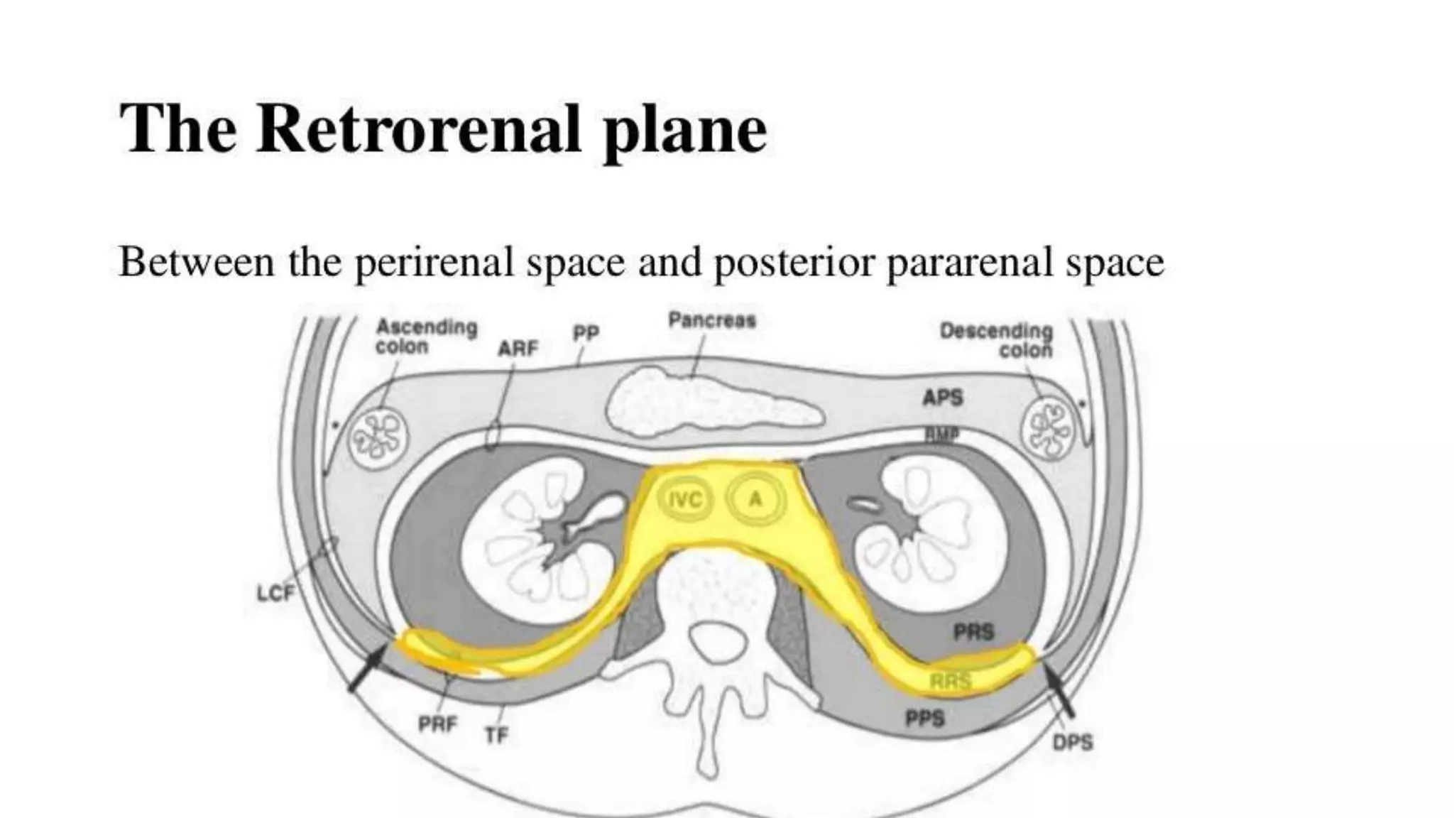 Radioanatomy of retroperitoneal space | PPTX