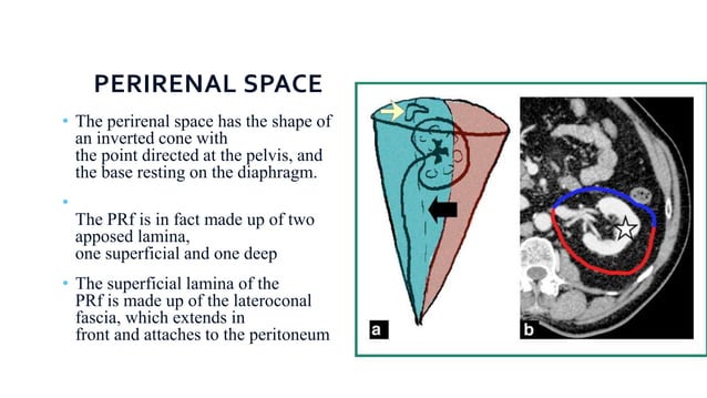 Radioanatomy of retroperitoneal space | PPTX | Design | Fine Art
