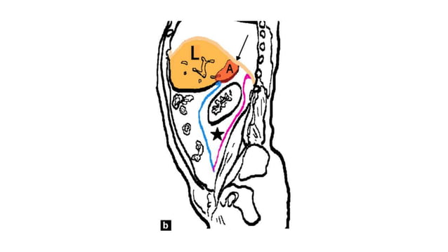 Radioanatomy of retroperitoneal space | PPTX | Design | Fine Art