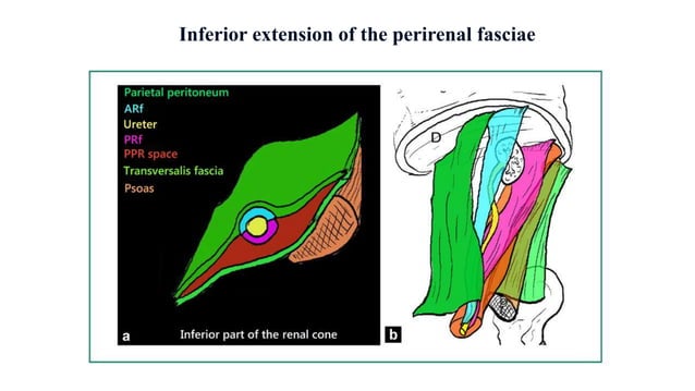 Radioanatomy of retroperitoneal space | PPTX | Design | Fine Art