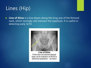 radiocapsule 8th may.pptx