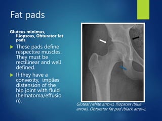 radiocapsule 8th may.pptx