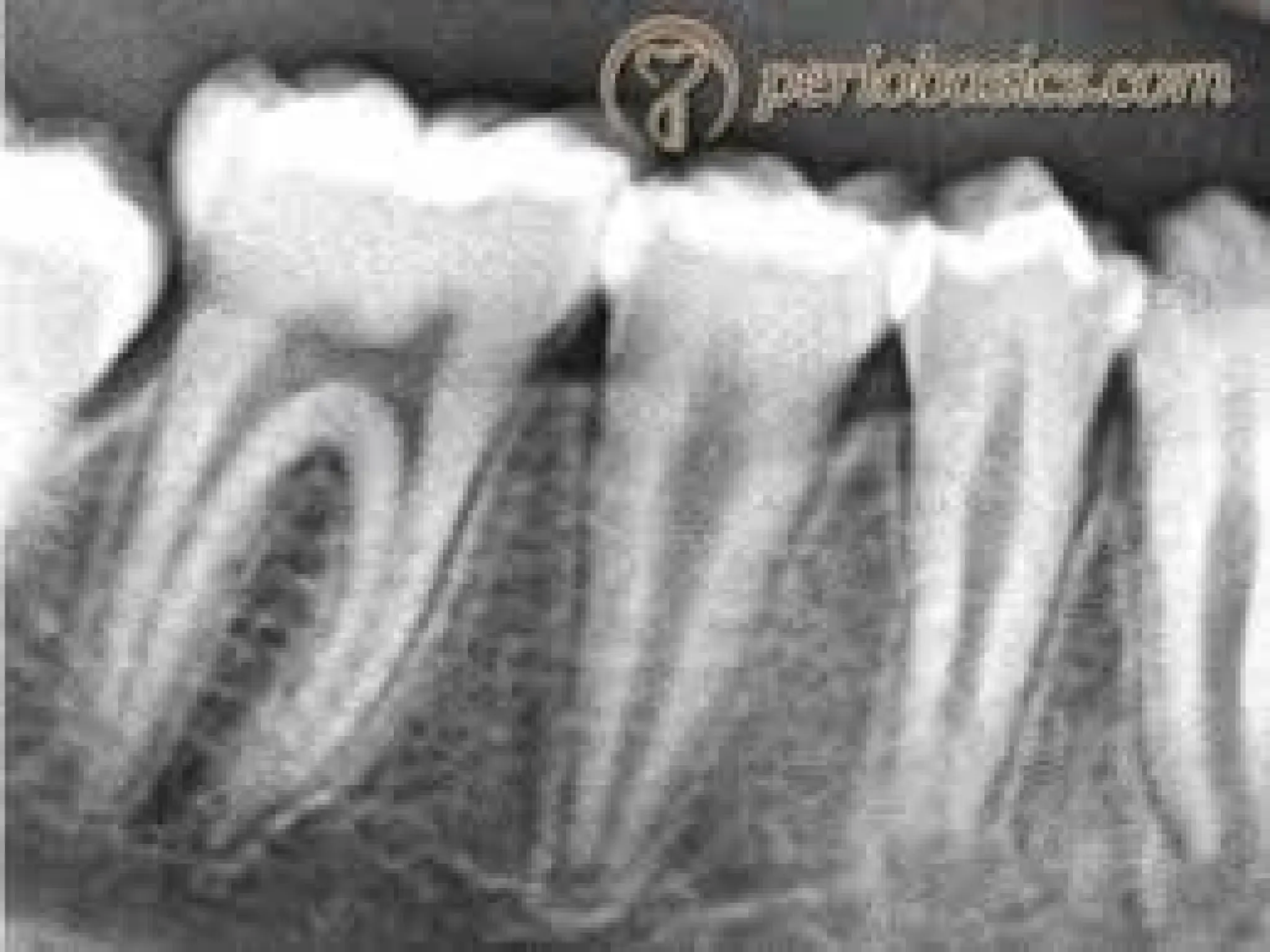 Radio dental anatomy 6,7 ppt teaching how radio anatomy worksin | PPTX