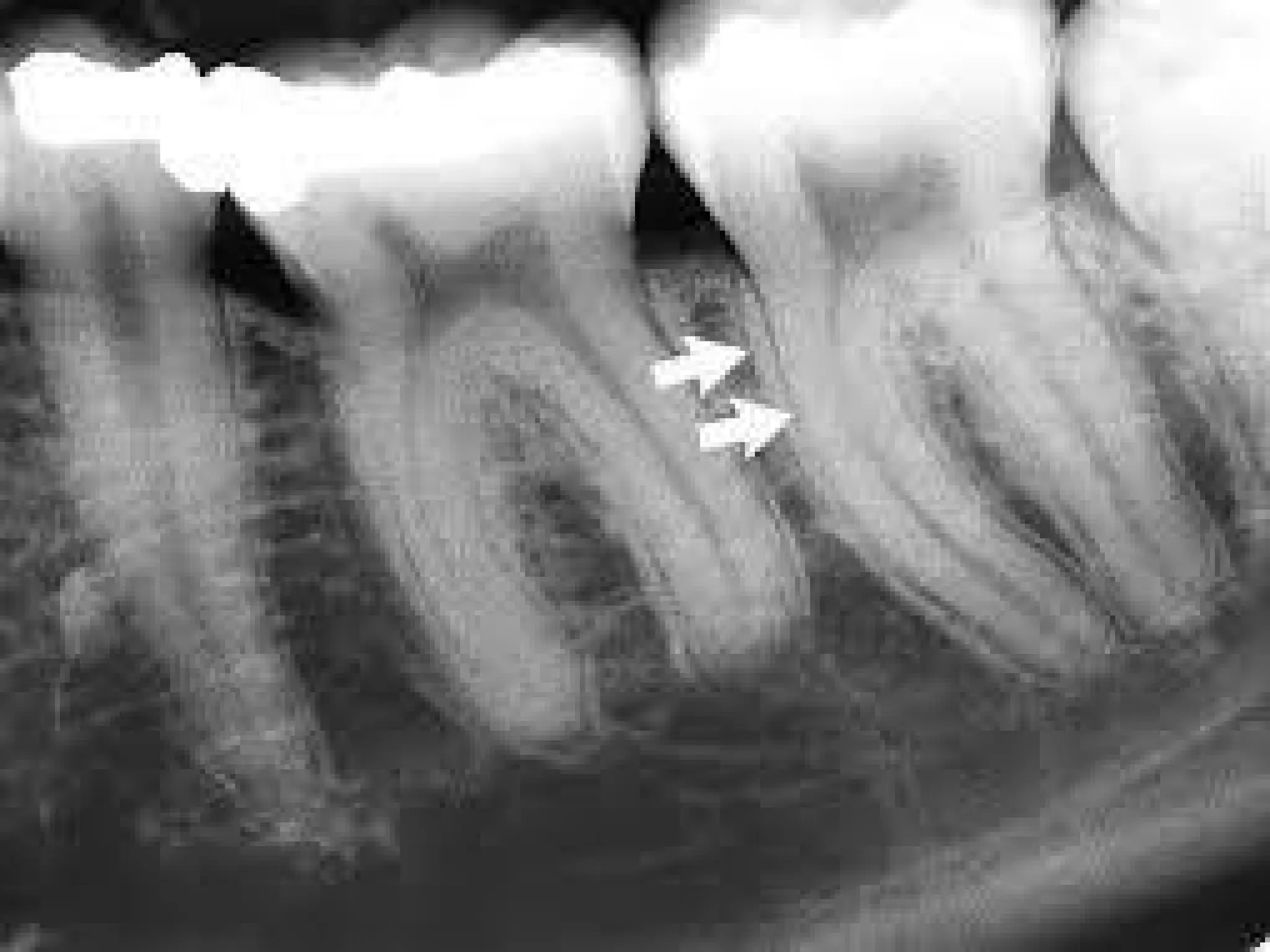 Radio dental anatomy 6,7 ppt teaching how radio anatomy worksin | PPTX