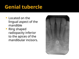 Radio dental anatomy 6,7 ppt teaching how radio anatomy worksin | PPTX