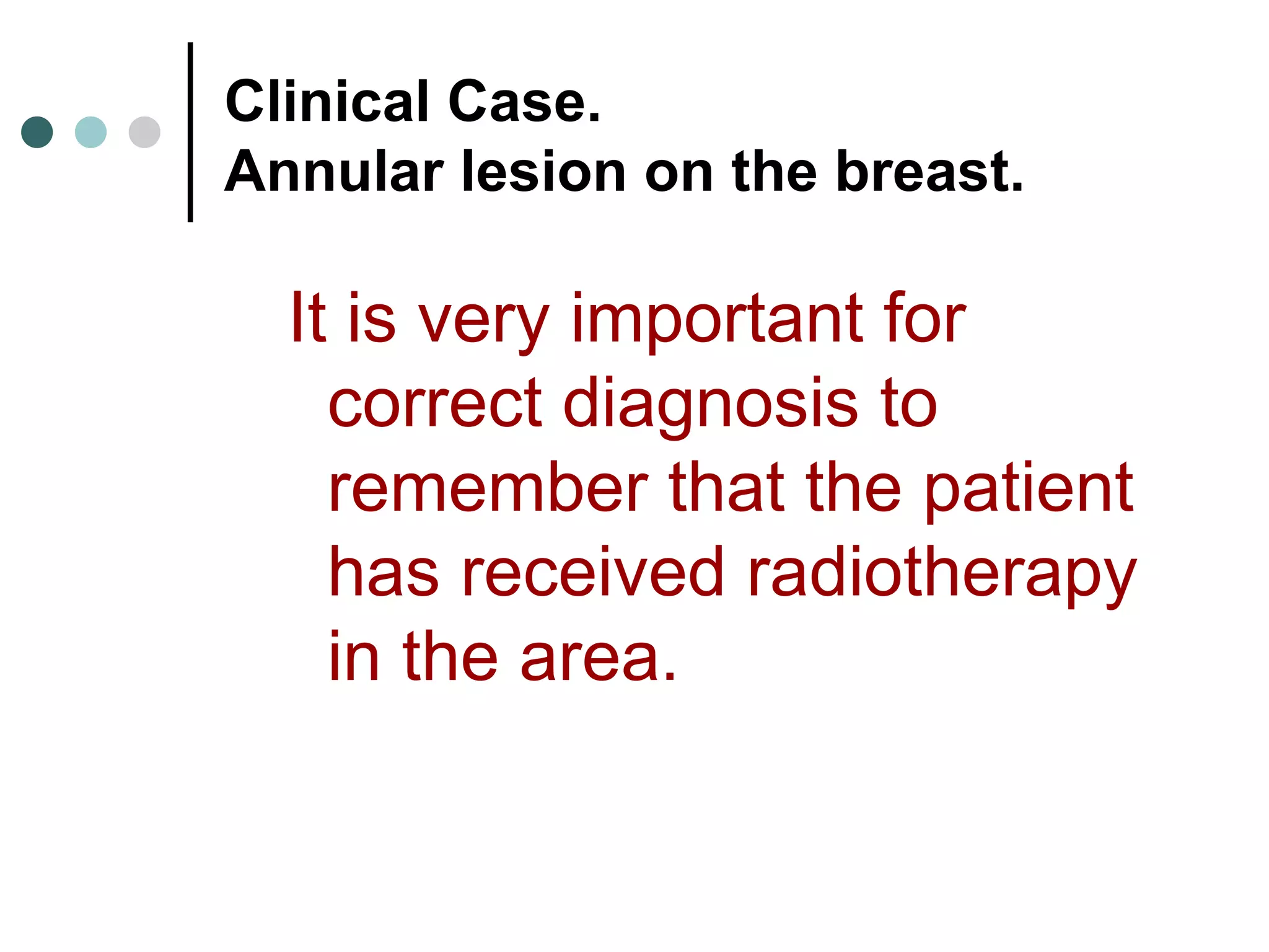 annular lesion on the breast | PPT