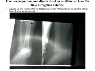 Radiodiagnostico practica 2 parte 2 | PPTX