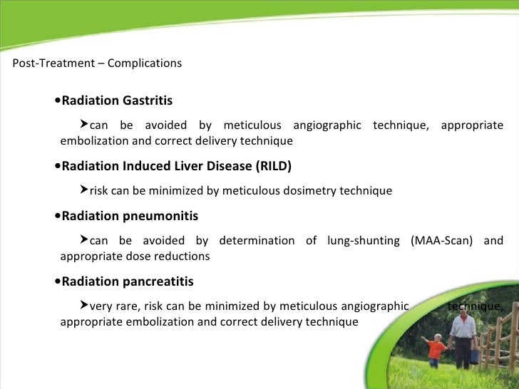 Radioembolization With Yttrium 90