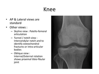 Radiological evaluation of Lower Limb in acute ED setting !! | PPT