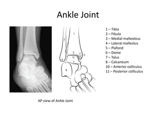 Radiological evaluation of Lower Limb in acute ED setting !! | PPTX